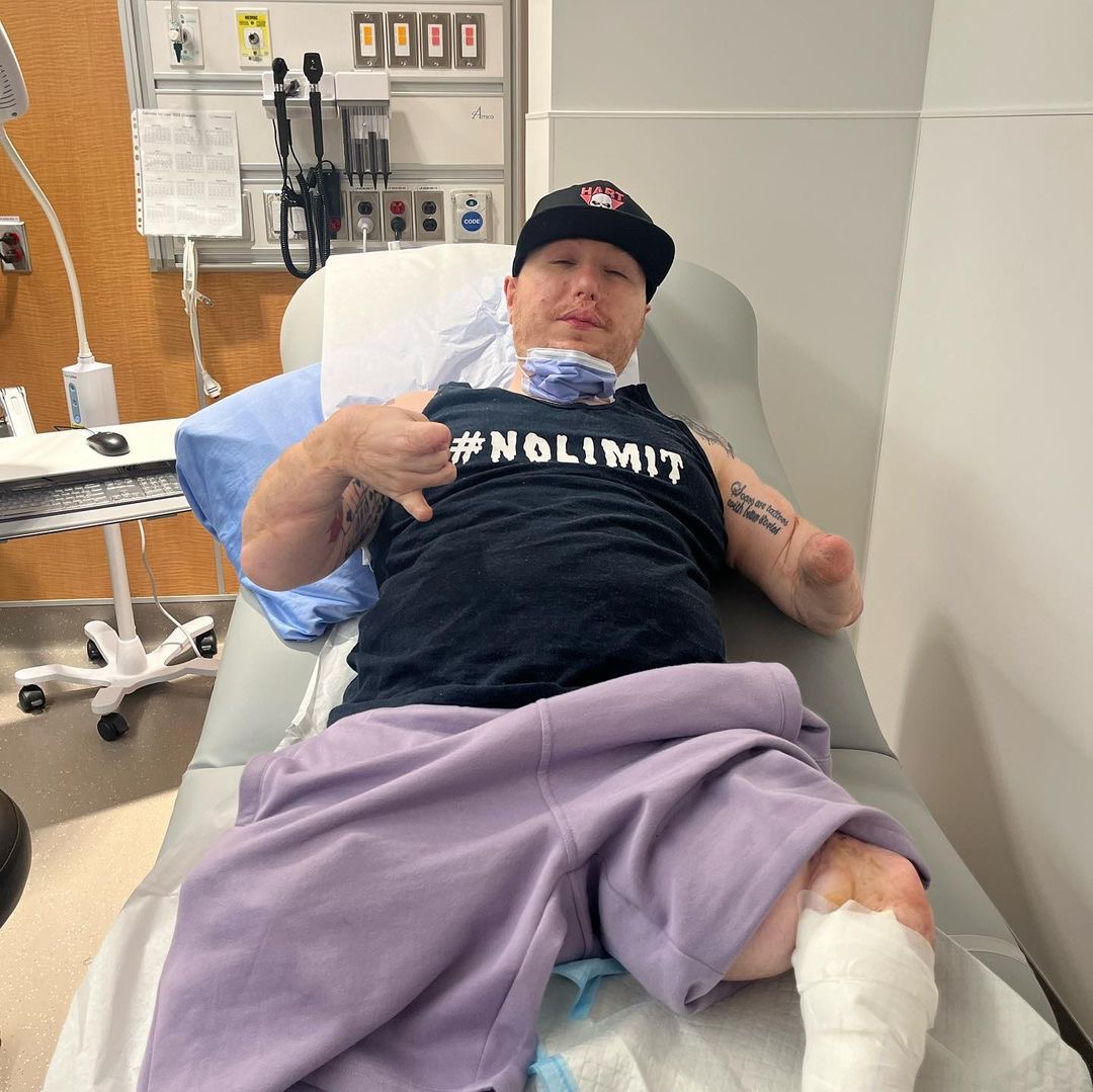 Shayne Smith undergoes procedure, steps back from Wheelchair Rugby ...